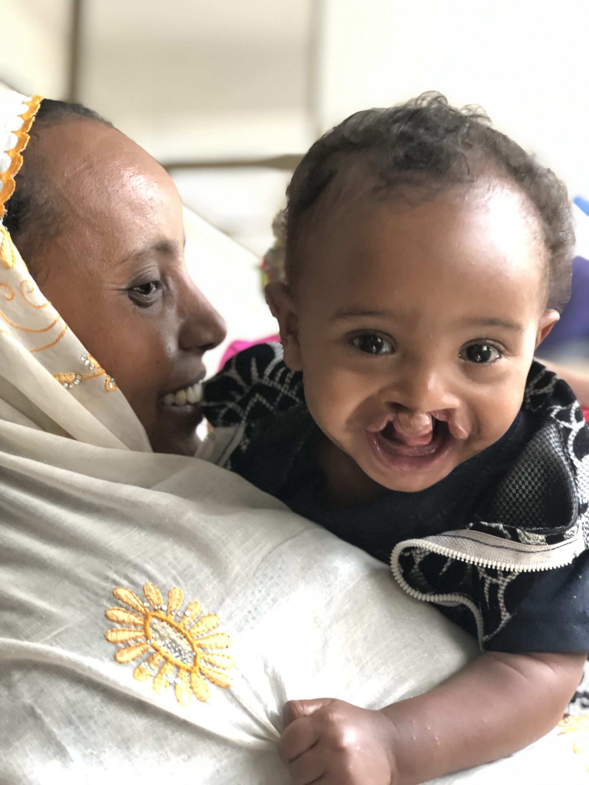 Children's Surgery International | A mother’s love and resolve